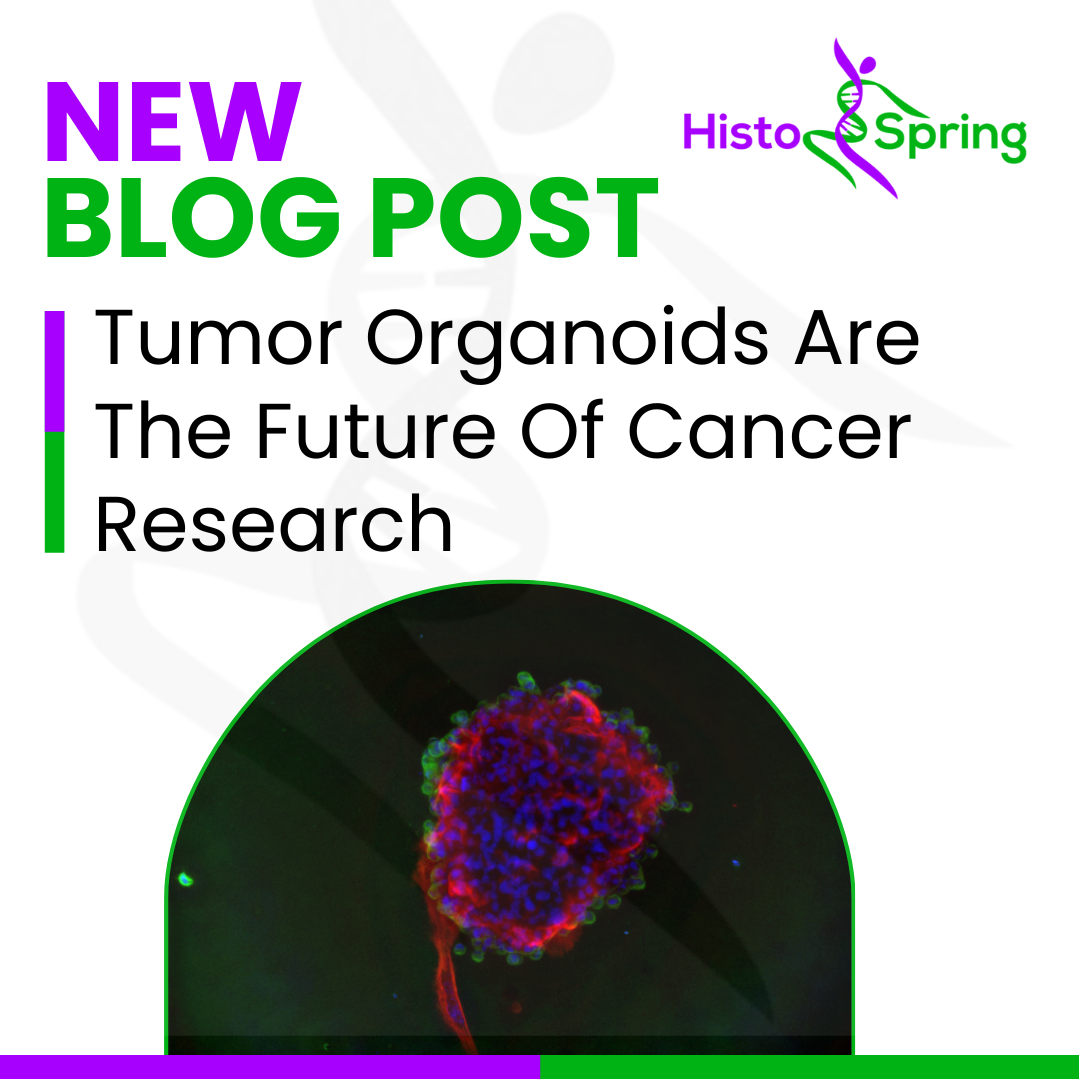 Tumor Organoids Are The Future Of Cancer Research - HistoSpring